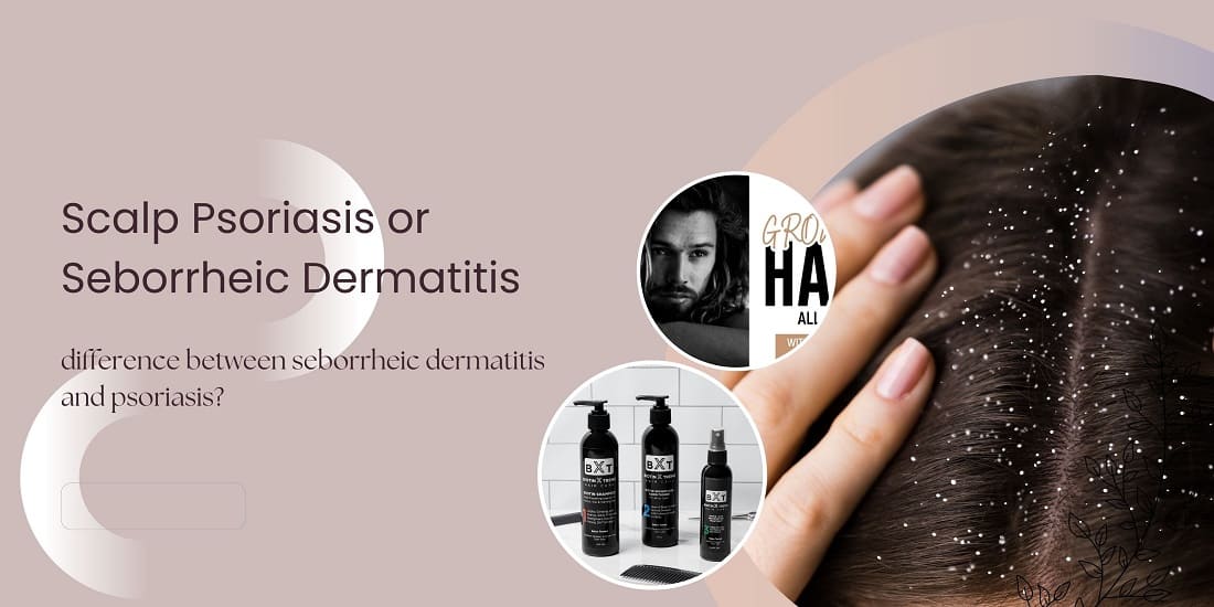 Scalp Psoriasis or Seborrheic Dermatitis? How to Know Your Hair Issue ...